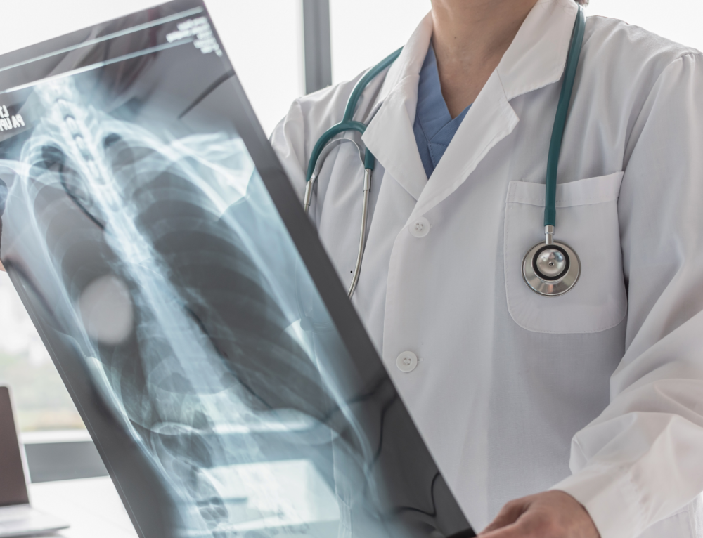 O papel da radiologia no diagnóstico precoce de doenças crônicas ...